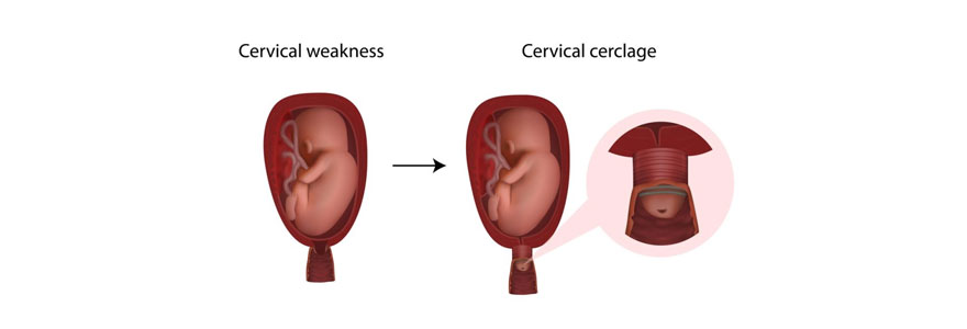 Best Gyneacologist in Kandivali | Dr. Dhanashree Salunkhe